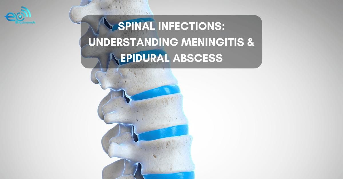 Spinal Infections: Understanding Meningitis & Epidural Abscess