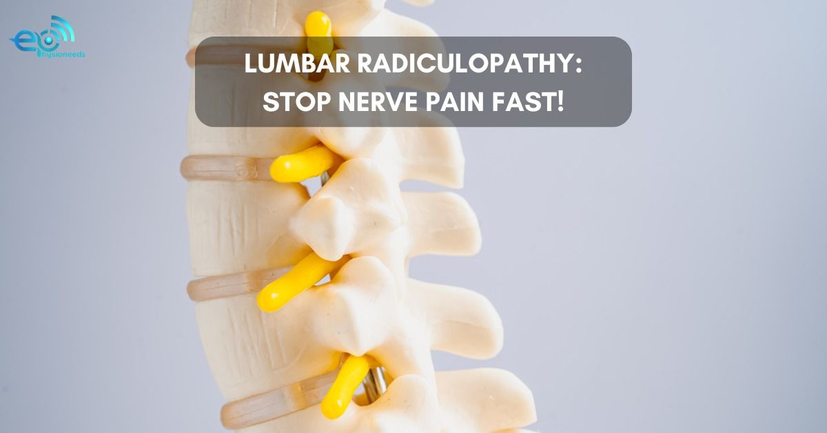 Lumbar Radiculopathy: Stop Nerve Pain Fast!