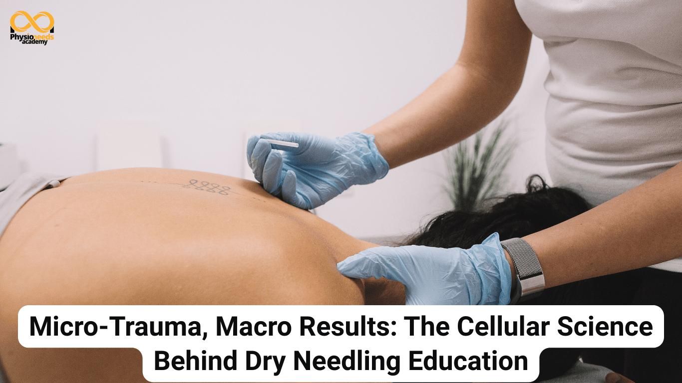 Micro-Trauma, Macro Results: Dry Needling Education & Certification